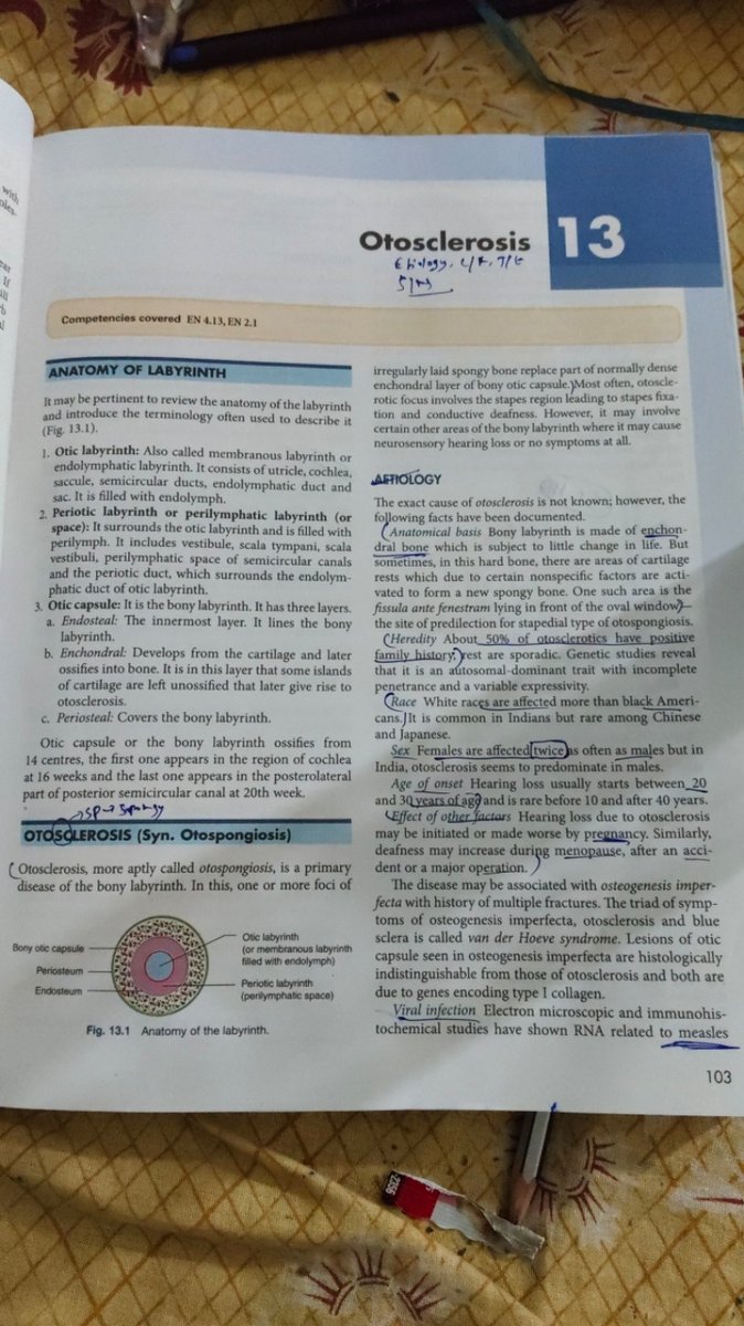 Explain the anatomy of the labyrinth and the etiology of otosclerosis bas..