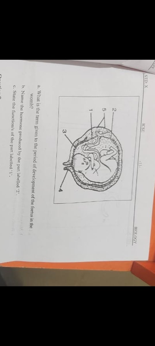 Biology Question Refer to the diagram of a developing fetus in the womb