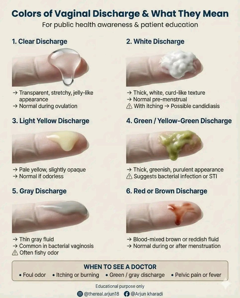 Colors of Vaginal Discharge & What They Mean For public health awareness