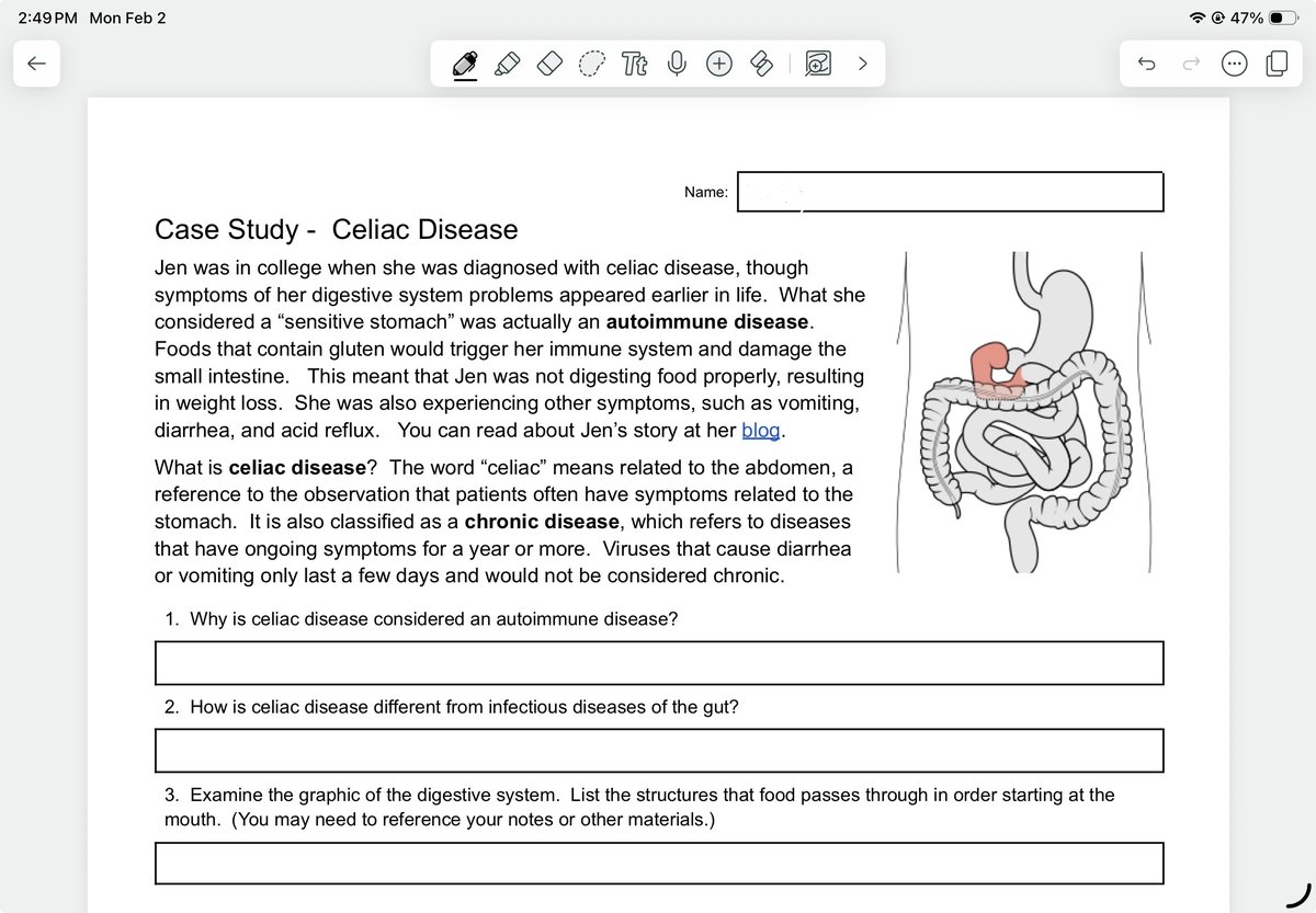 Case Study - Celiac Disease Jen was in college when she was diagnosed wi..
