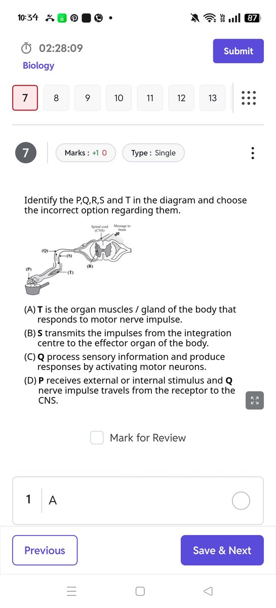 Identify the P, Q, R, S, and T in the diagram and choose the incorrect op..