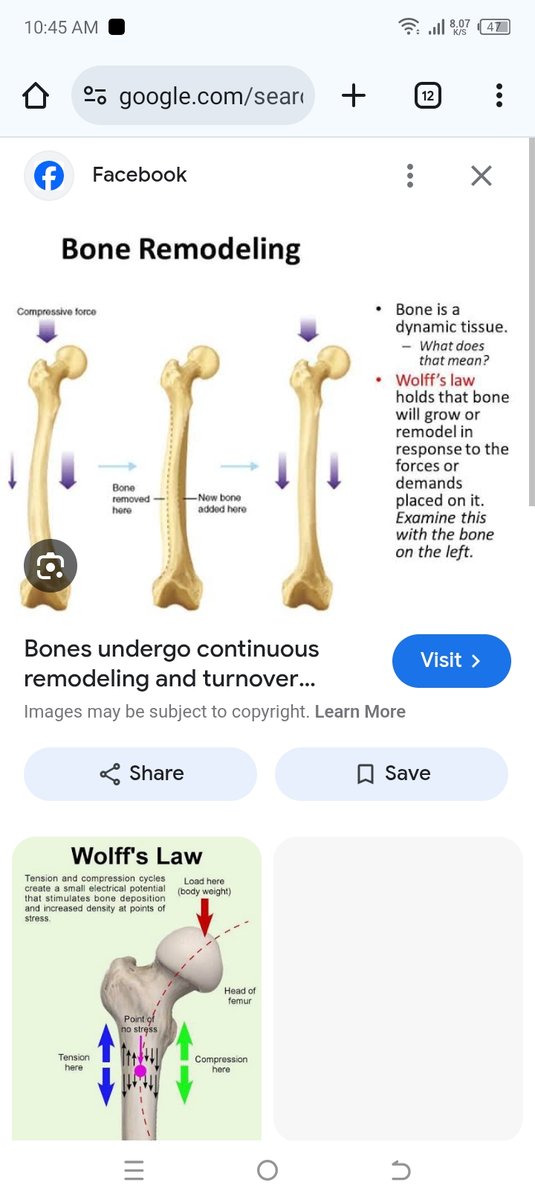 Bone Remodeling Bones undergo continuous remodeling and turnover... Wol..
