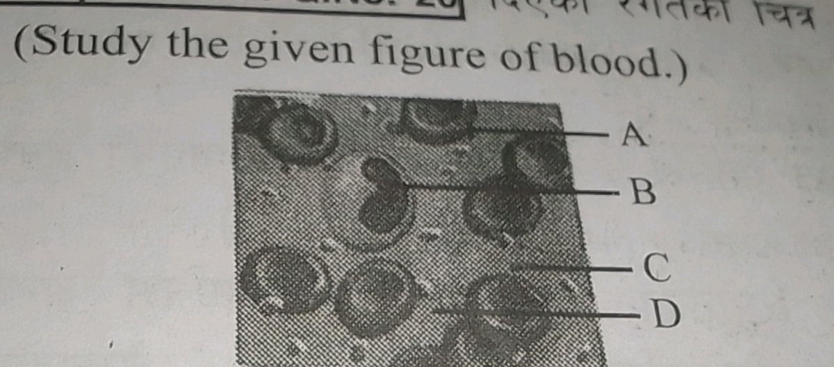 Study the given figure of blood. (The image shows a microscopic view of