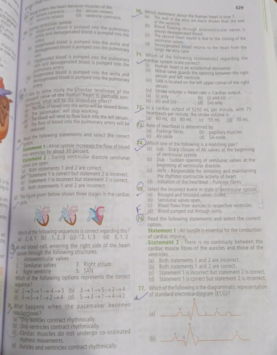 The figure given below shows three stages in the cardiac cycle. [Image o..