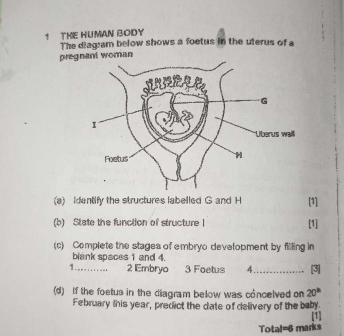 THE HUMAN BODY The diagram below shows a foetus in the uterus of a pregna..