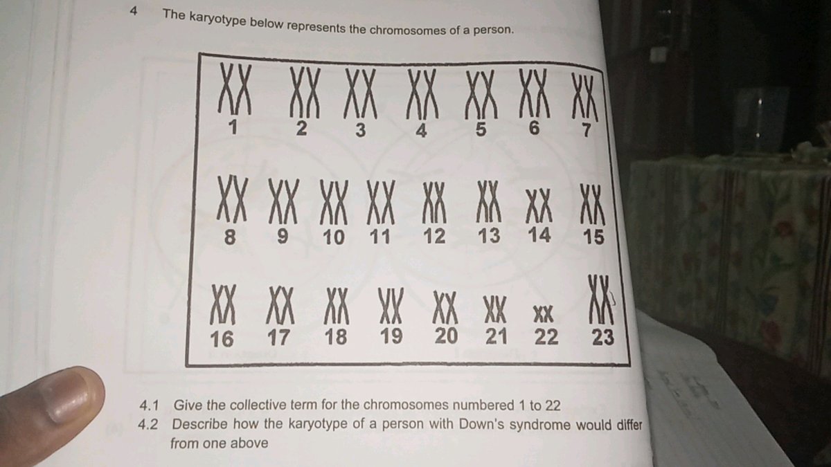 The karyotype below represents the chromosomes of a person. [Diagram of