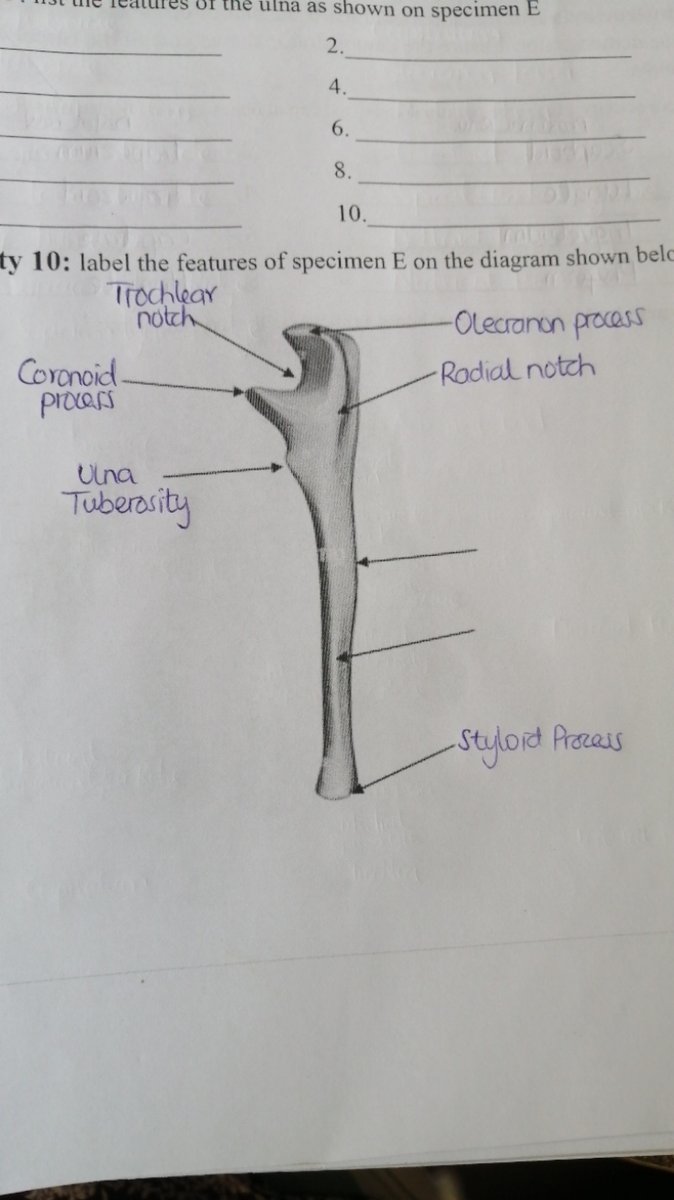 Label the features of specimen E on the diagram shown below: Trochlear n..