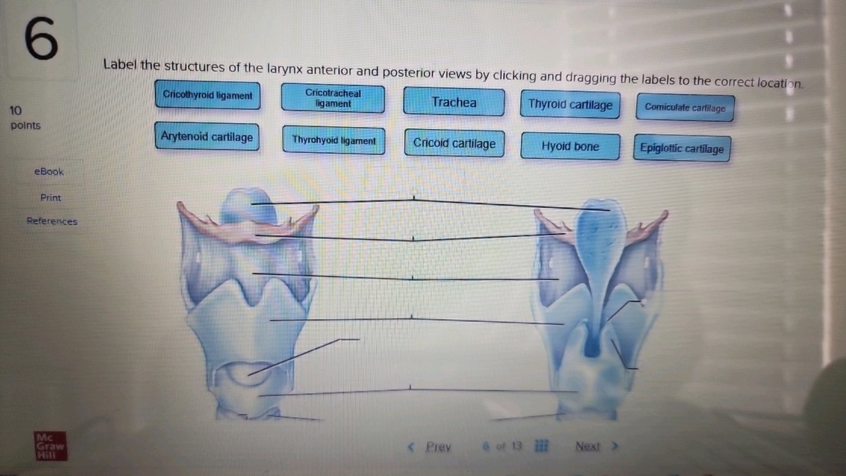 Label the structures of the larynx anterior and posterior views by clicki..