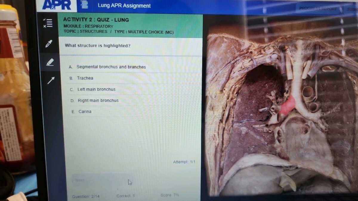 What structure is highlighted? A. Segmental bronchus and branches B. Tra..