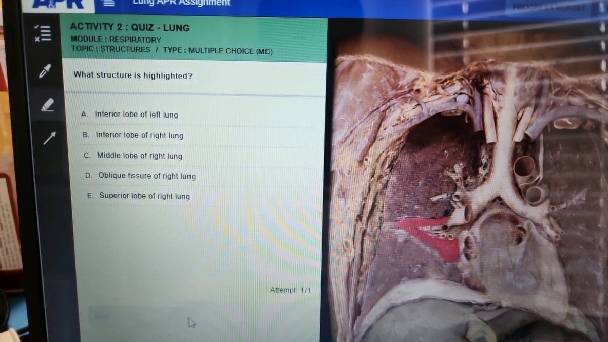 ACTIVITY 2: QUIZ - LUNG MODULE: RESPIRATORY TOPIC: STRUCTURES / TYPE: MUL..