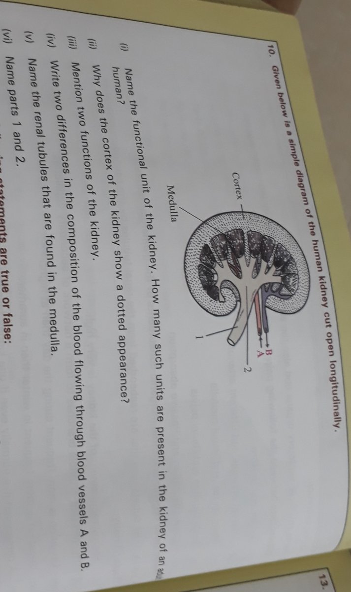 Given below is a simple diagram of the human kidney cut open longitudinal..