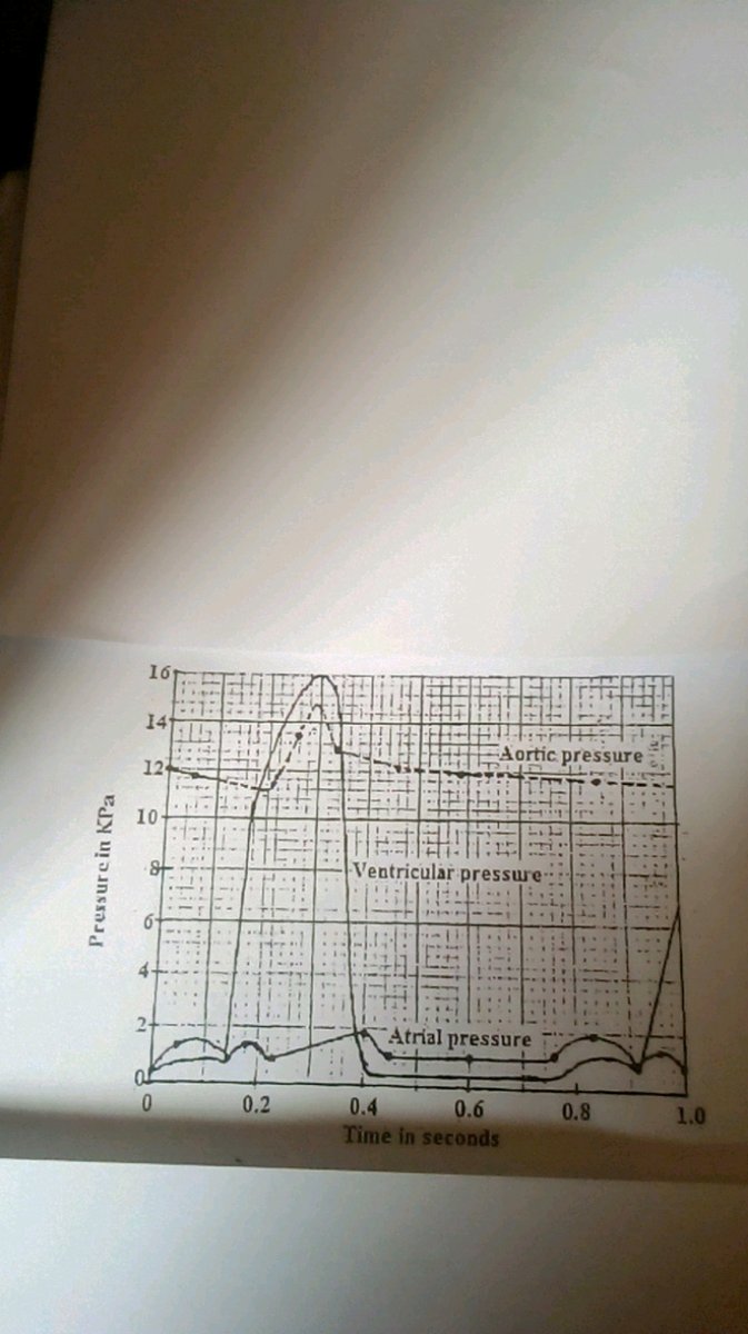 The image provided displays a graph showing Aortic pressure, Ventricular
