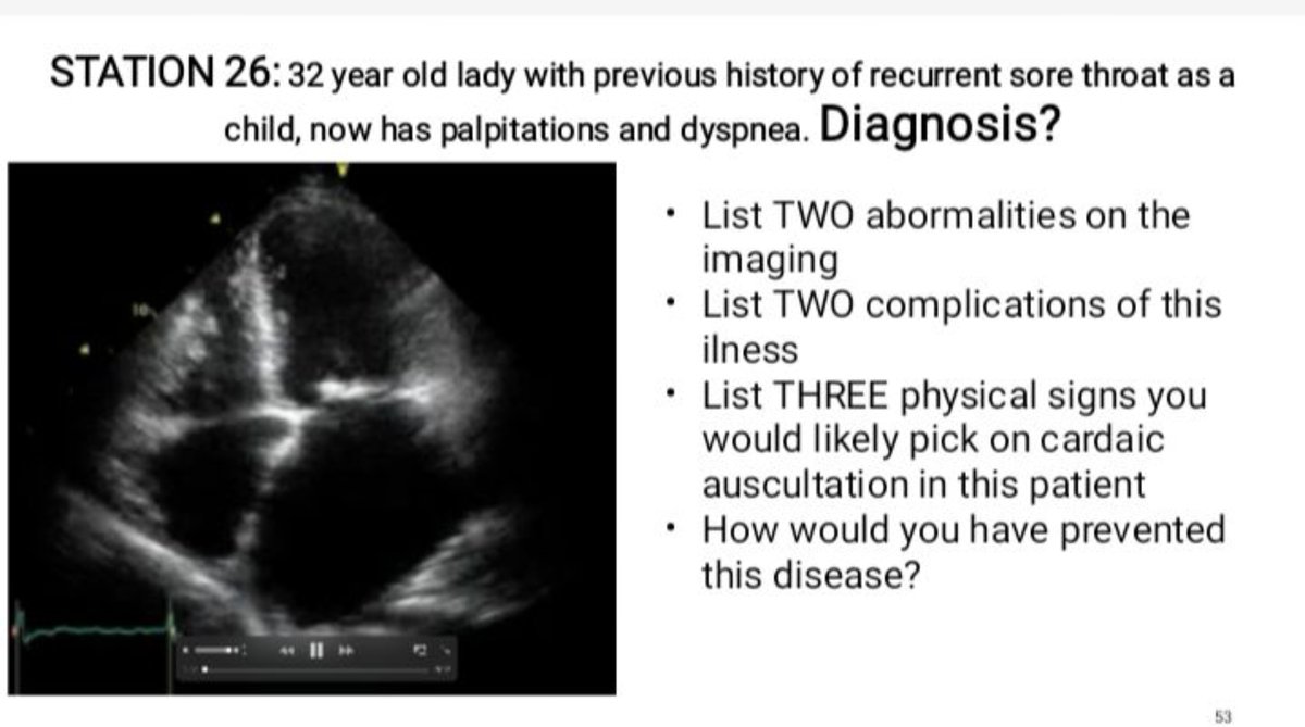 STATION 26: 32 year old lady with previous history of recurrent sore thro..