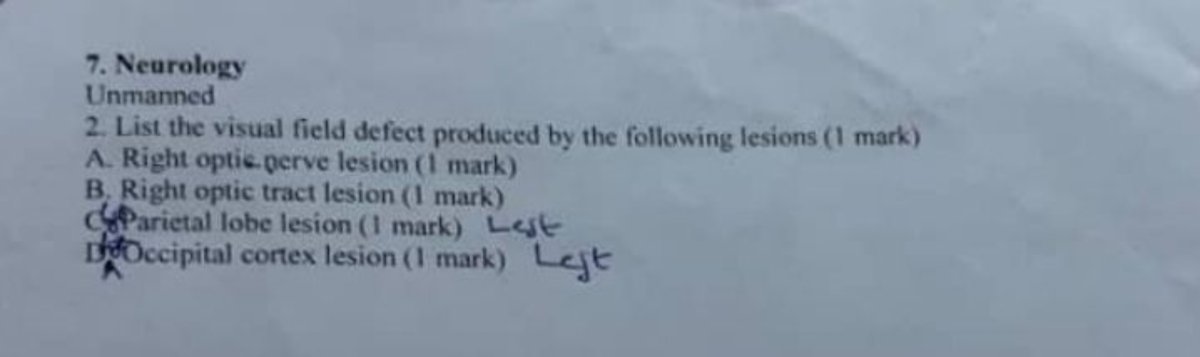 Neurology Unmanned List the visual field defect produced by the following..