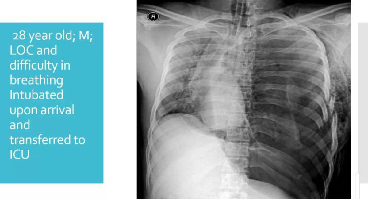 A 28-year-old male presented with loss of consciousness (LOC) and difficu..