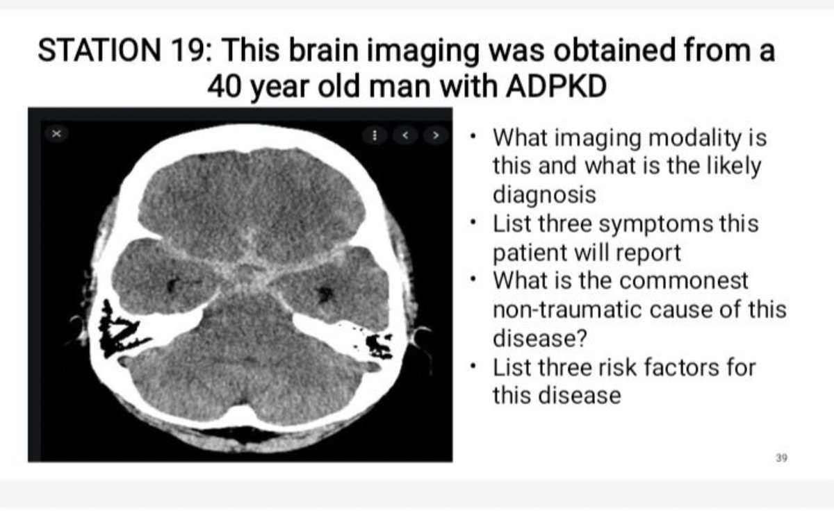 STATION 19: This brain imaging was obtained from a 40-year-old man with A..