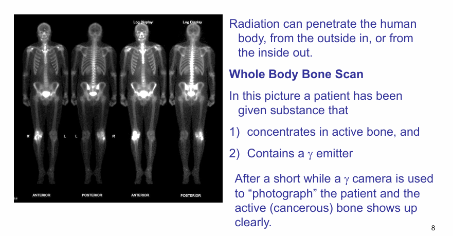 Radiation can penetrate the human body, from the outside in, or from the