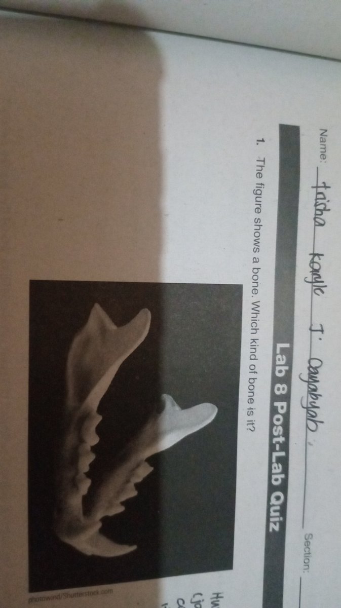 The figure shows a bone. Which kind of bone is it? | Filo