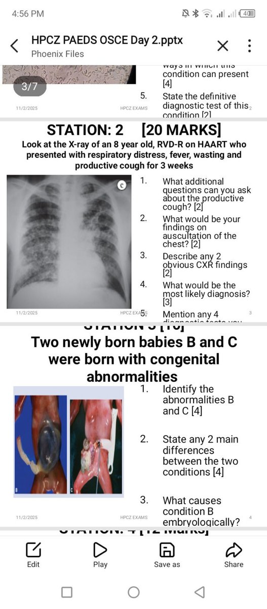 Two newly born babies B and C were born with congenital abnormalities. I..