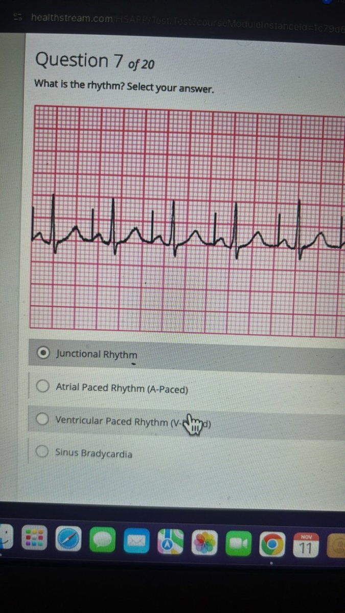 Question 7 of 20 What is the rhythm? Select your answer. [Image of an EC..