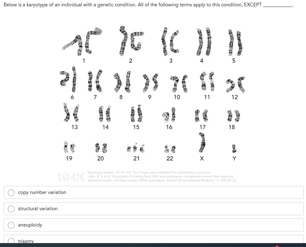 Below is a karyotype of an individual with a genetic condition. All of th..