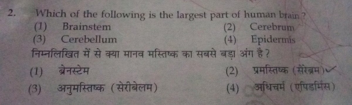 Which of the following is the largest part of human brain? (1) Brainstem