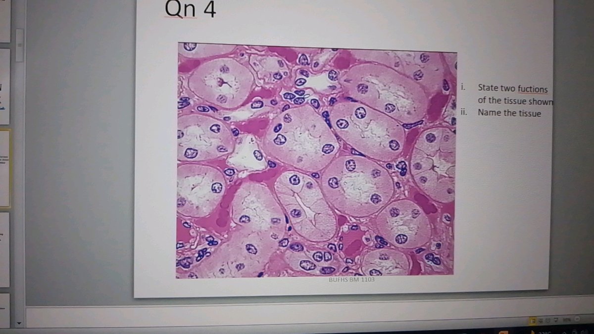 Qn 4 i. State two functions of the tissue shown ii. Name the tissue..