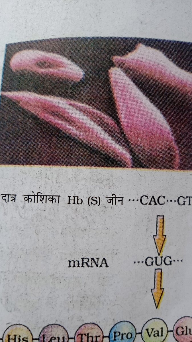 दात्र कोशिका Hb (S) जीन CAC... GT mRNA GUG... His Leu Thr Pro Val Glu Ba..