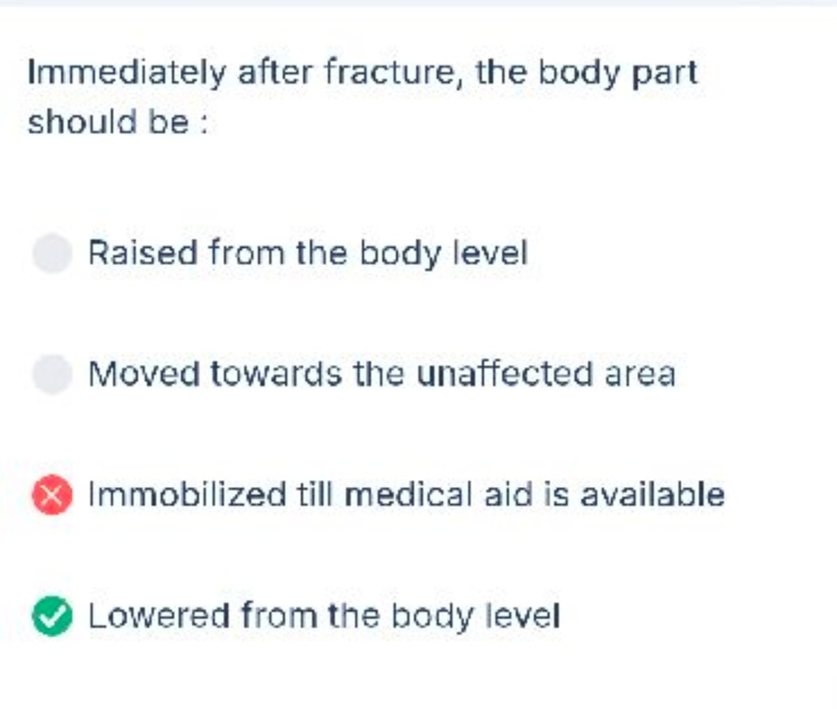 Immediately after fracture, the body part should be: Raised from the bod..
