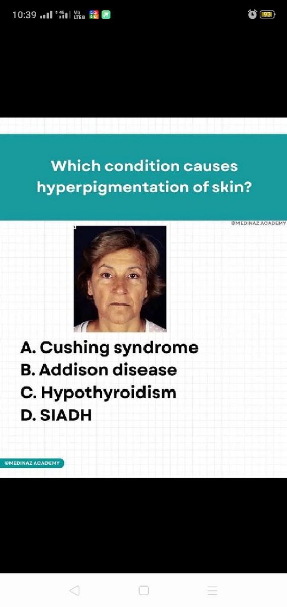 Which condition causes hyperpigmentation of skin? A. Cushing syndrome B.