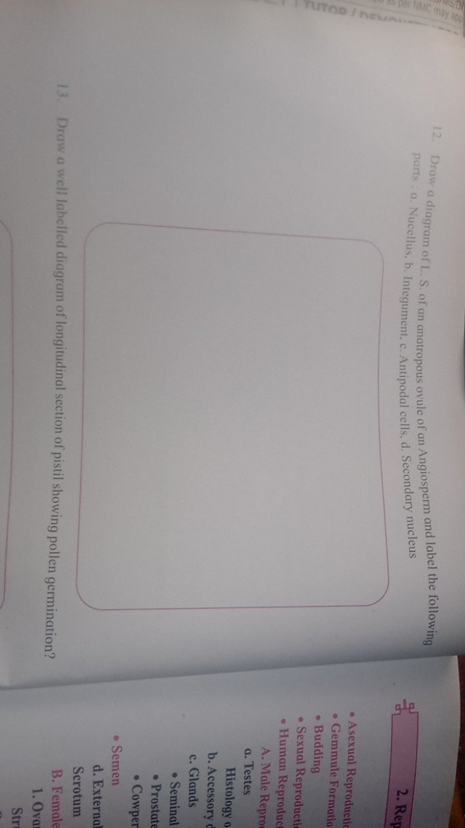 Draw a diagram of L. S. of an anatropous ovule of an Angiosperm and label..