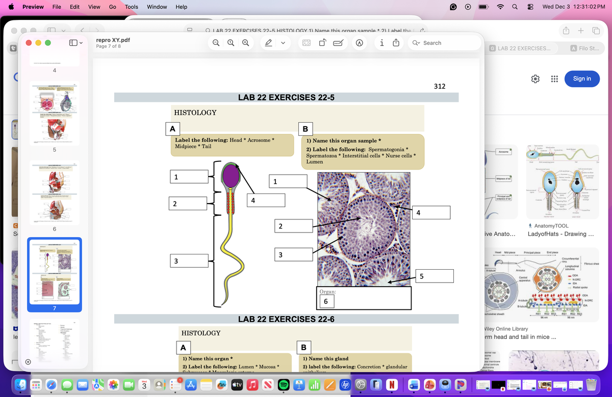 LAB 22 EXERCISES 22-5 HISTOLOGY A Label the following: Head * Acrosome