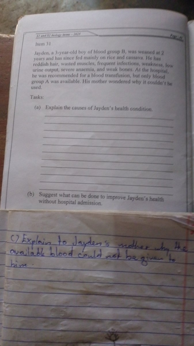 S1 and S2 biology items-2025 Item 31 Jayden, a 3-year-old boy of blood