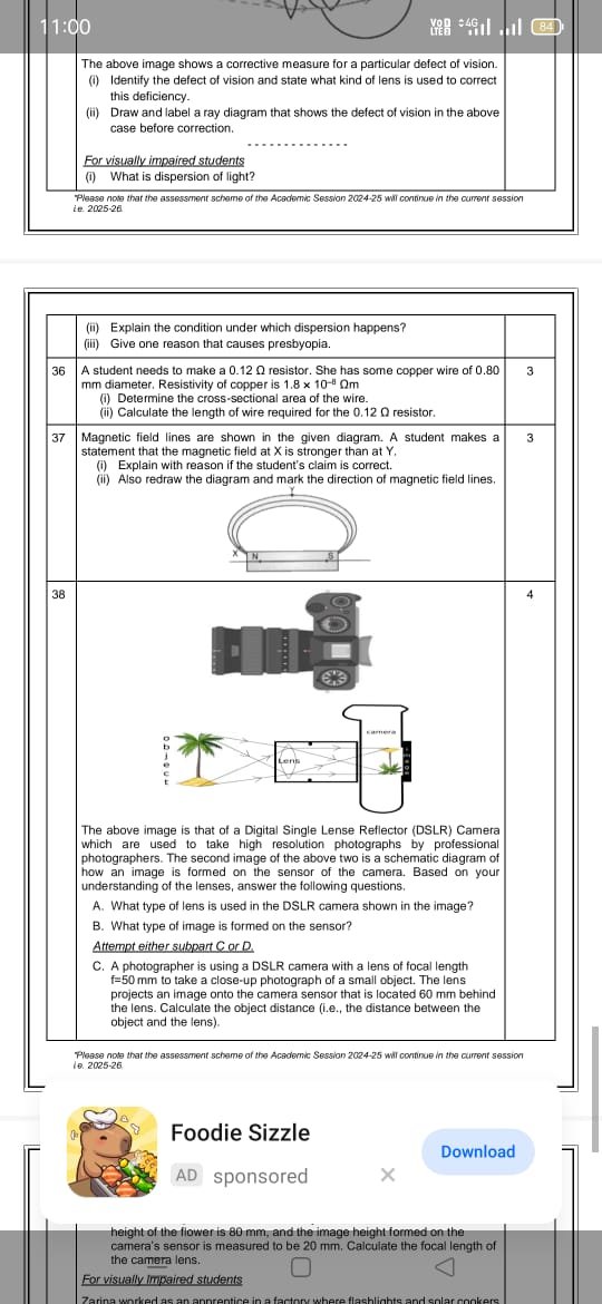The above image shows a corrective measure for a particular defect of vis..