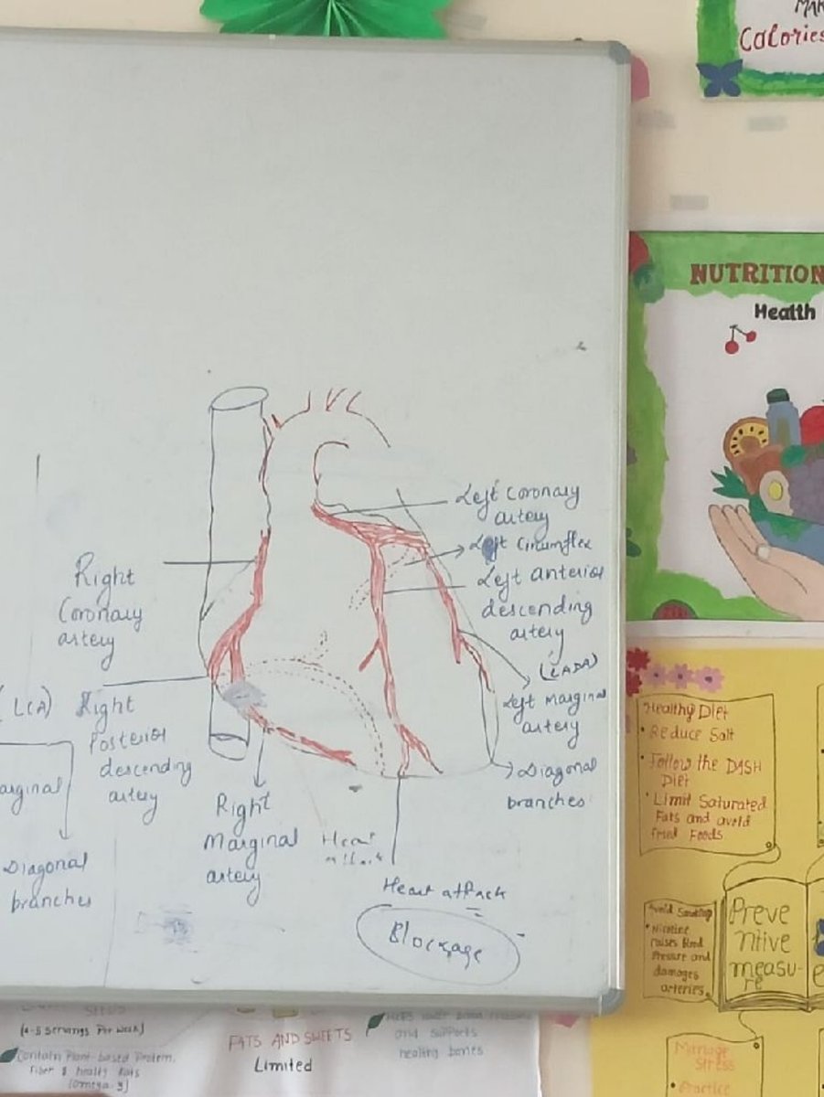 The image displays a diagram of the human heart with its coronary arterie..