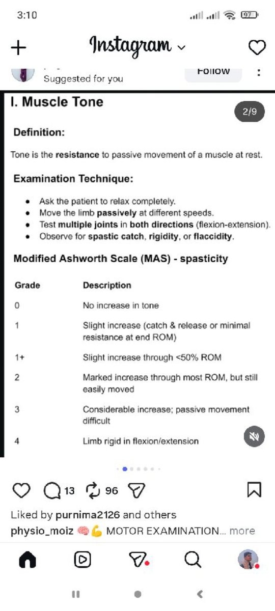 I. Muscle Tone Definition: Tone is the resistance to passive movement of..