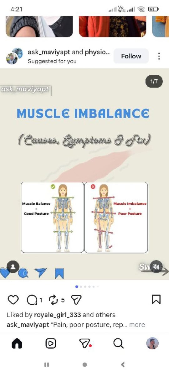 MUSCLE IMBALANCE (Causes, Symptoms & Fix) Muscle Balance = Good Posture