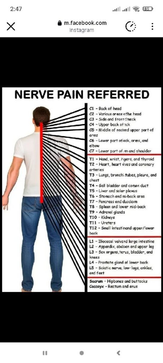 The provided image illustrates "Nerve Pain Referred" and lists various ne..