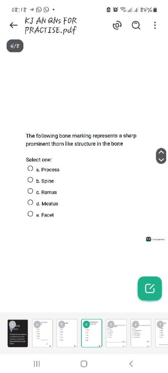 The following bone marking represents a sharp prominent thorn like struct..