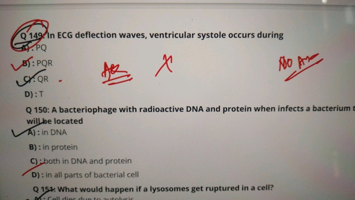 Q 149. In ECG deflection waves, ventricular systole occurs during A) PQ B..