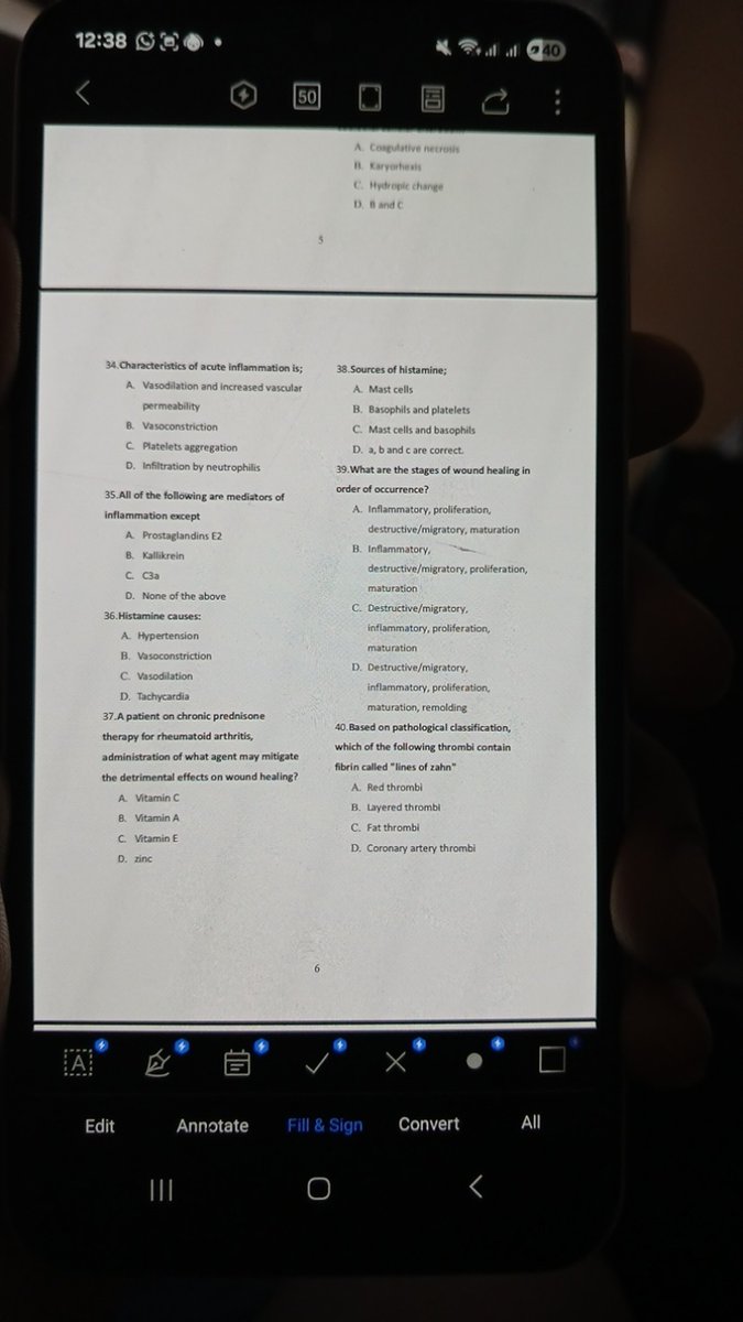 Characteristics of acute inflammation is; A. Vasodilation and increased v..