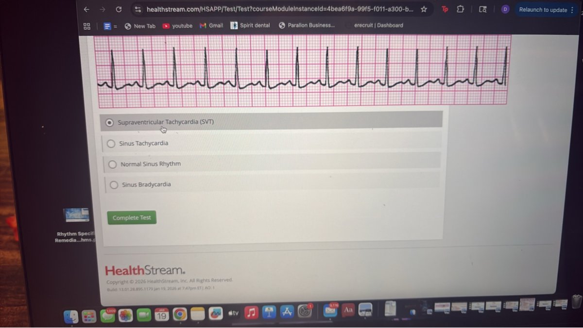 The image displays an electrocardiogram (ECG) strip. Based on the ECG, wh..
