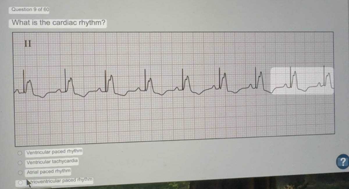 What is the cardiac rhythm? [Image of an ECG graph] A. Ventricular pace..