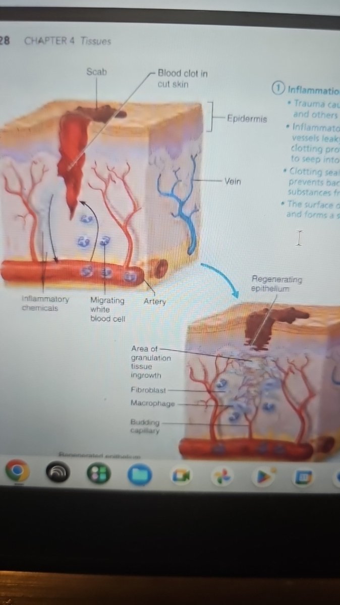 The provided image illustrates the process of inflammation and tissue rep..