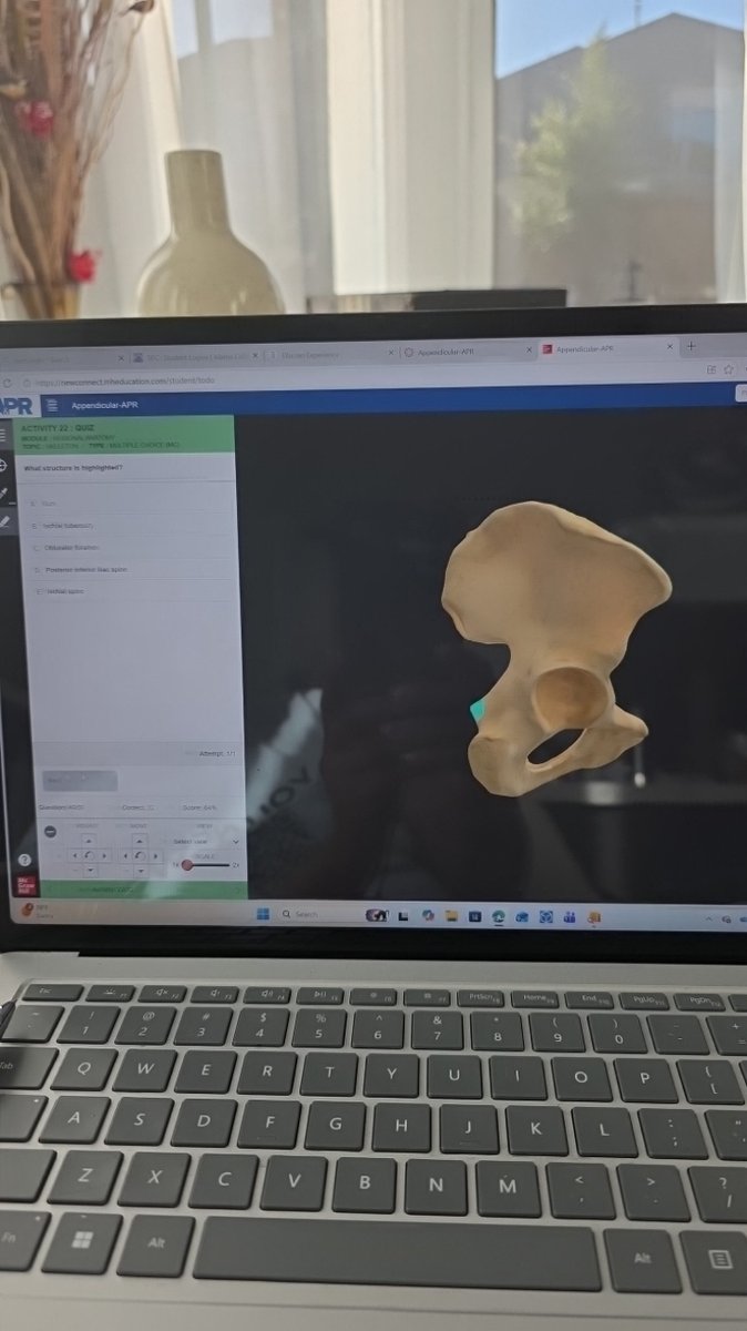 What structure is highlighted? A. Ilium B. Ischial tuberosity C. Obturat..