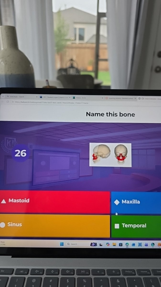 Name this bone. Options: Mastoid Sinus Maxilla Temporal | Filo