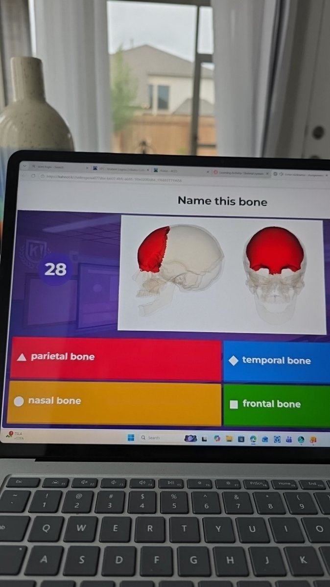 Name this bone: (Image of a human skull with the frontal bone highlighte..