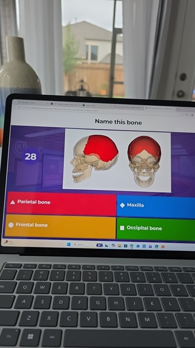 Name this bone Options: Parietal bone Frontal bone Maxilla Occipital bon..