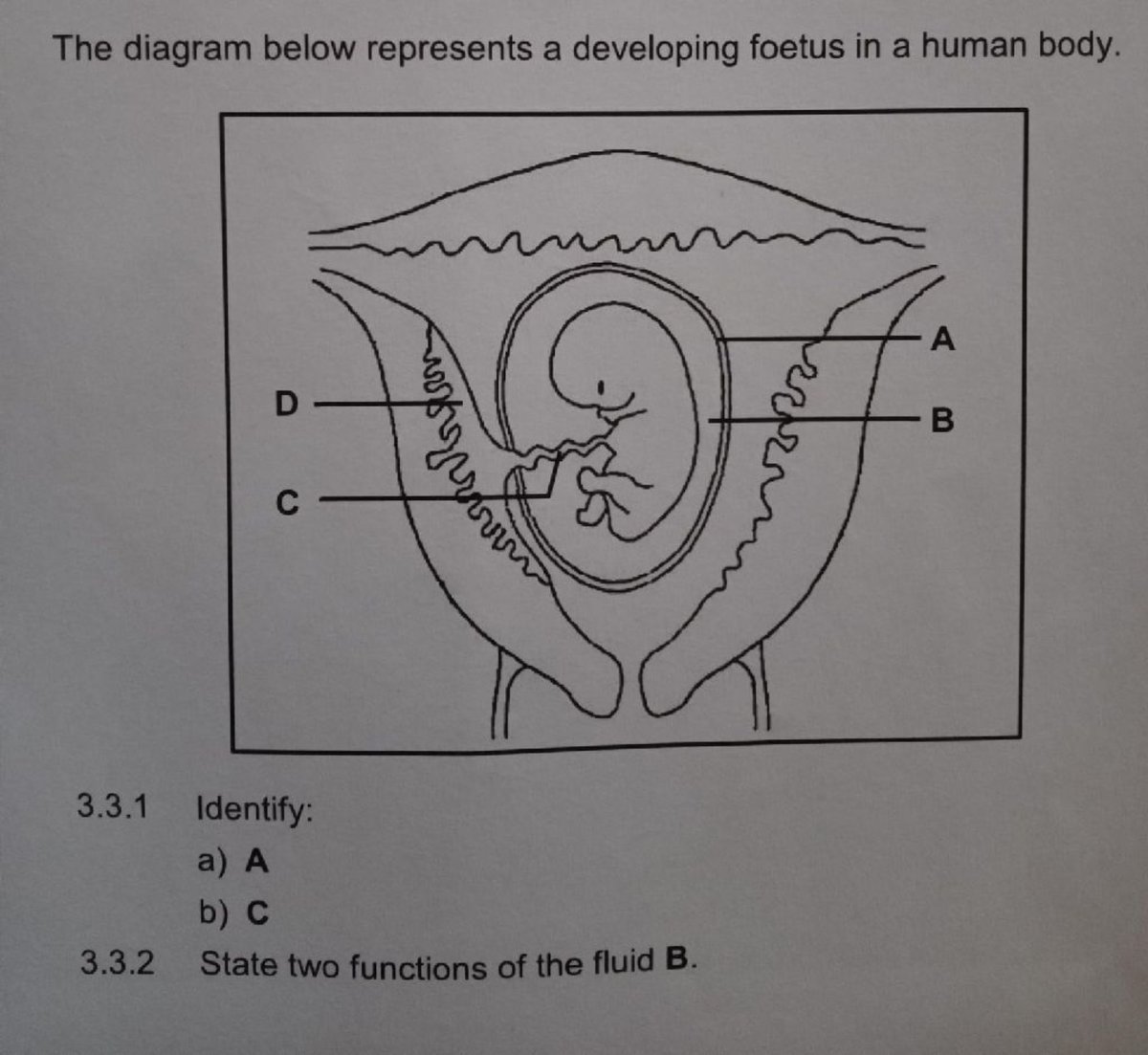 The diagram below represents a developing foetus in a human body. [Diagr..