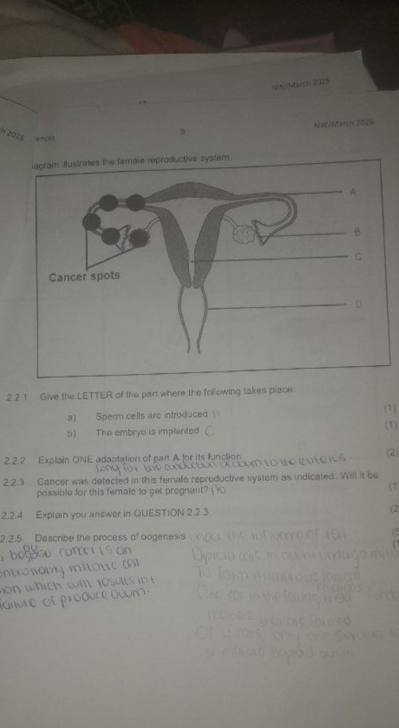 The diagram illustrates the female reproductive system. Cancer spots 2...